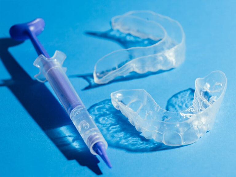 Take Home Whitening Kit - Sunstone Dental Clinic in Delta